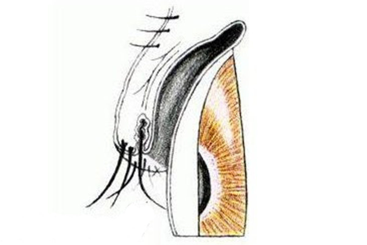 La DISTIQUIASIS Canina: Qué es y cómo tratarla - Guía Completa